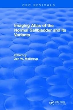 Imaging Atlas Of The Normal Gallbladder And Its Variants Of The Normal ...